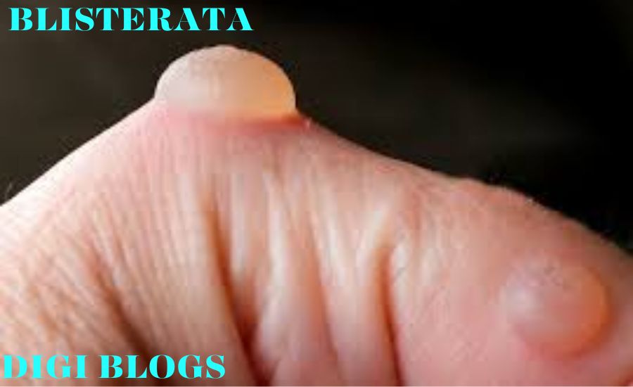 What is Blisterata? Decoding the Benefits and Mechanisms